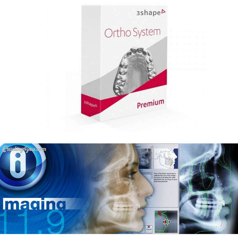 Комп`ютер + 3shape ortho analyzer + Dolphin Orthodontics БУ, $2000 ...